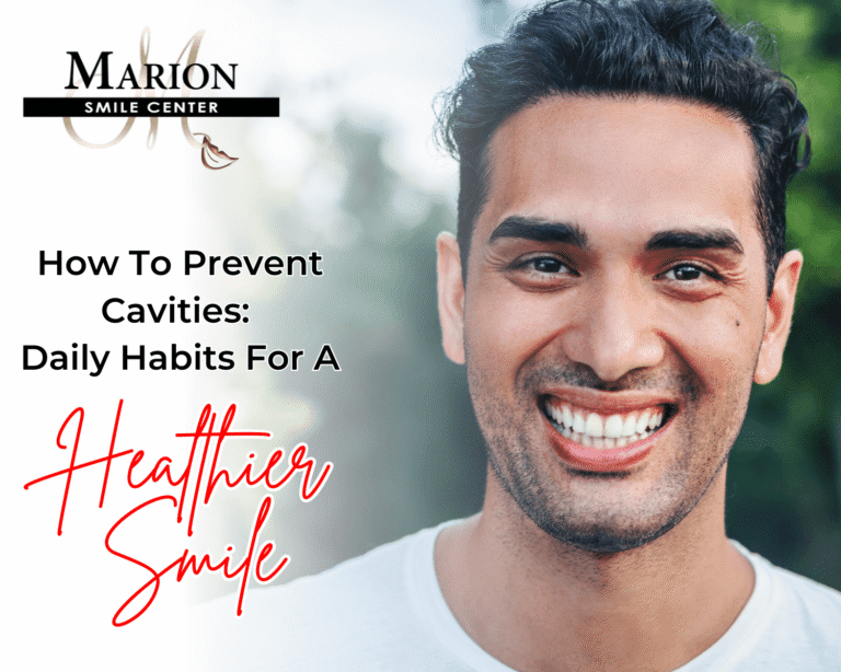How to Prevent Cavities: Daily Habits for a Healthier Smile - Marion ...